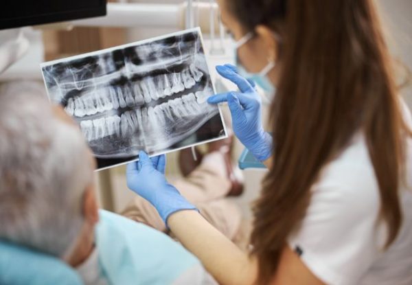 Rayos X dentales: Características esenciales para elegir tu equipo