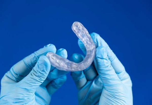 Férulas Dentales: tipos, beneficios y cómo elegirlas